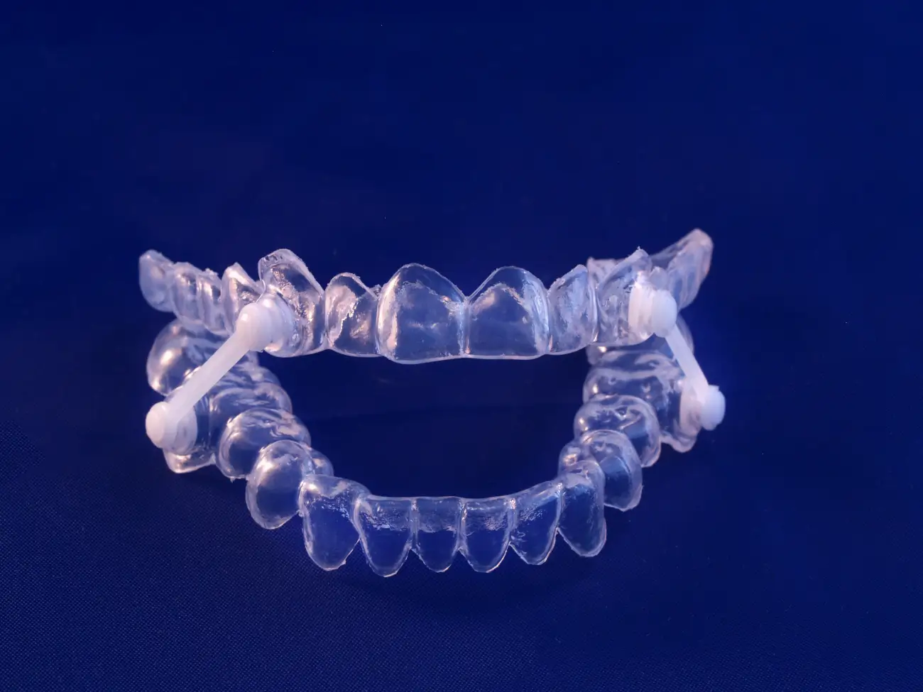 Udlaga za zube 🦷 Saznaj koja udlaga ti je potrebna | Dentus perfectus ...