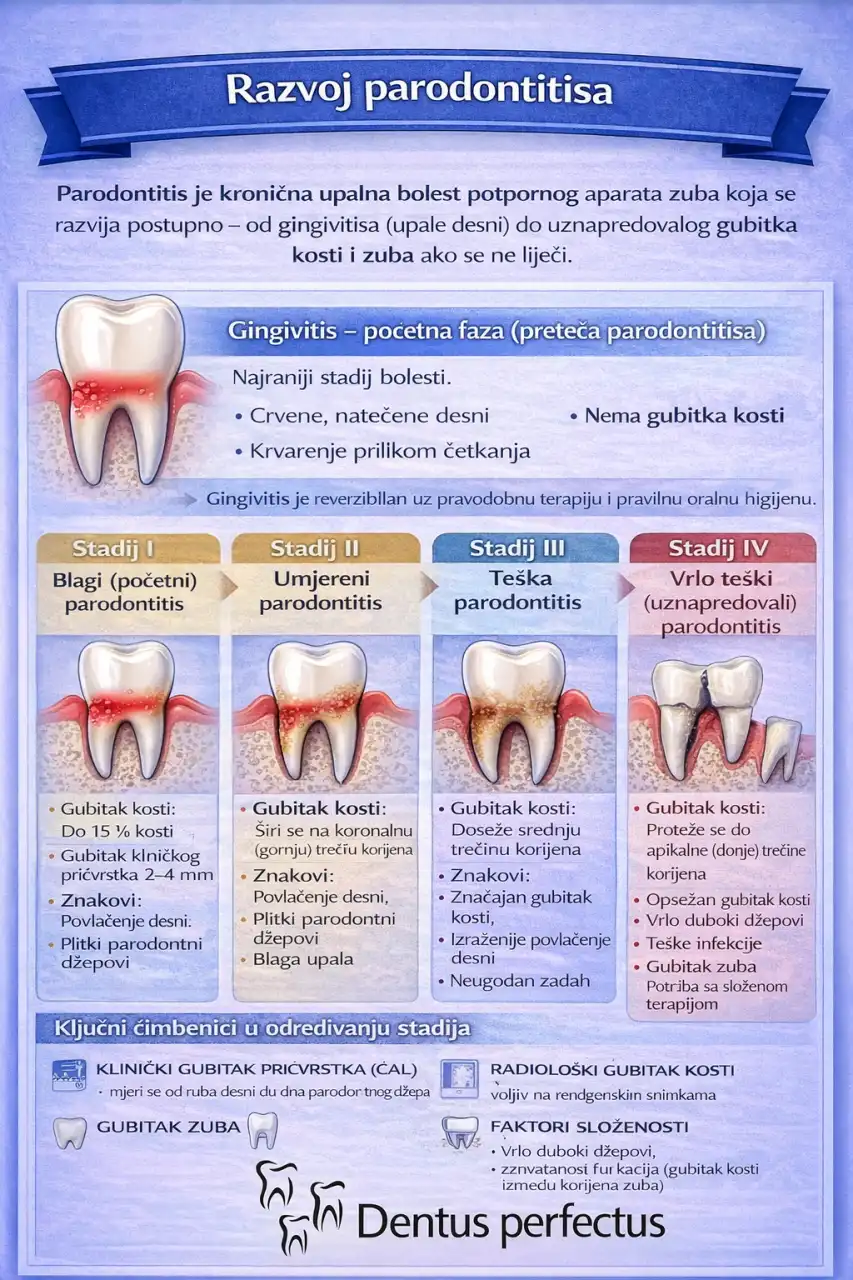 Parodontologija – bolesti desni, simptomi i terapija | Dentus perfectus